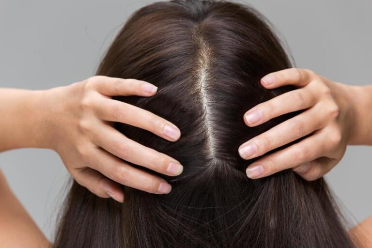Scalp Scabs and Sores: What They Are and How to Get Rid of Them ...
